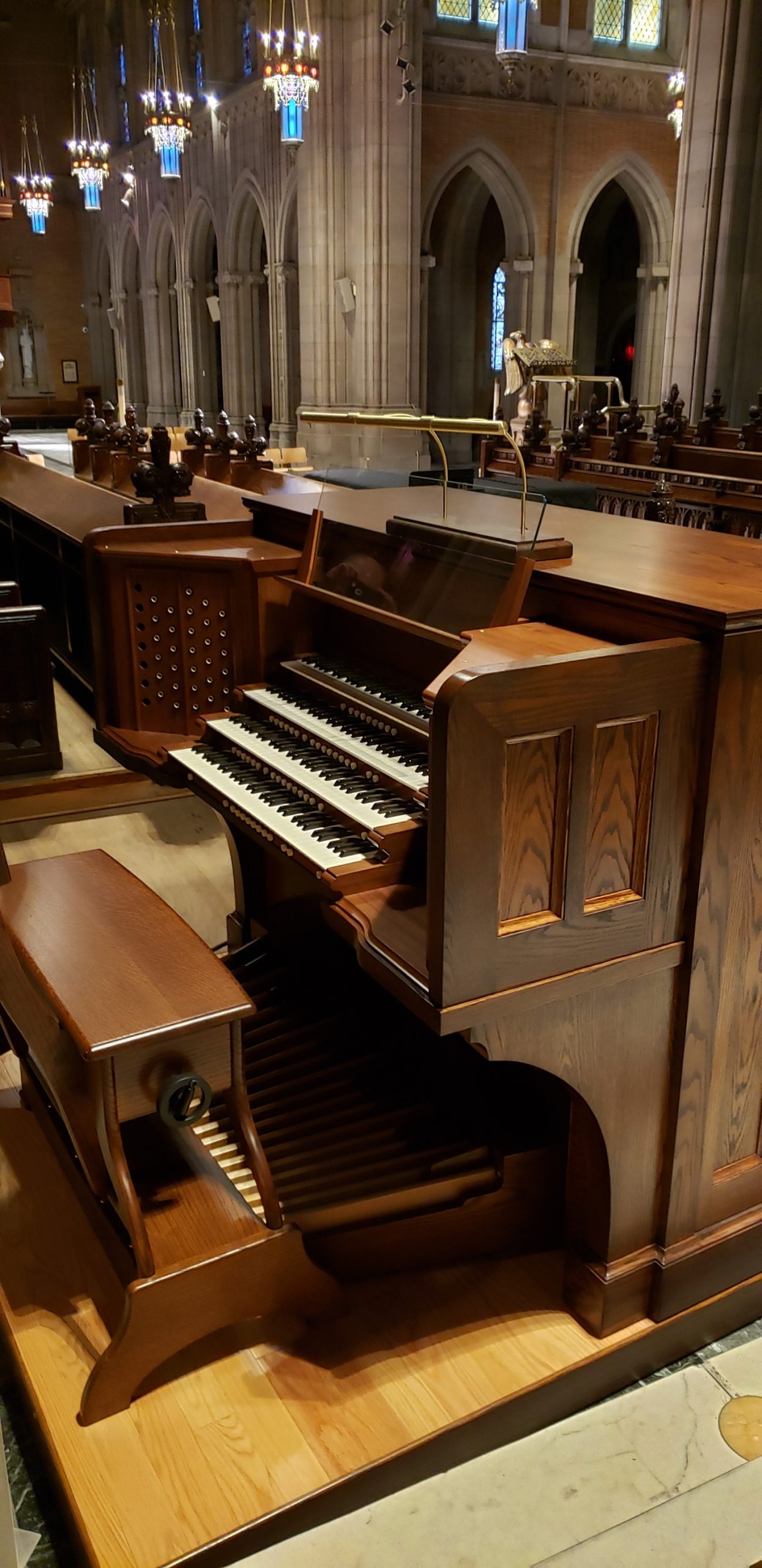 Skinner organ transplants are well underway at Trinity - Cleveland ...